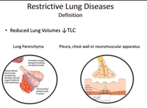 Restrictive Lung Diseases Flashcards Quizlet