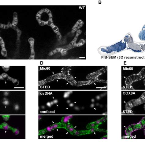 Pdf Micos Assembly Controls Mitochondrial Inner Membrane Remodeling And Crista Junction