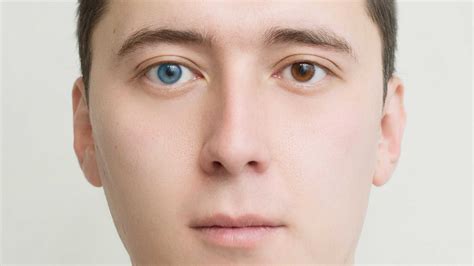Central Heterochromia Statistics Fdxp