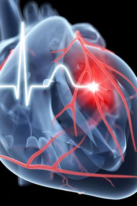 Health Copd Congestive Heart Failure Artofit