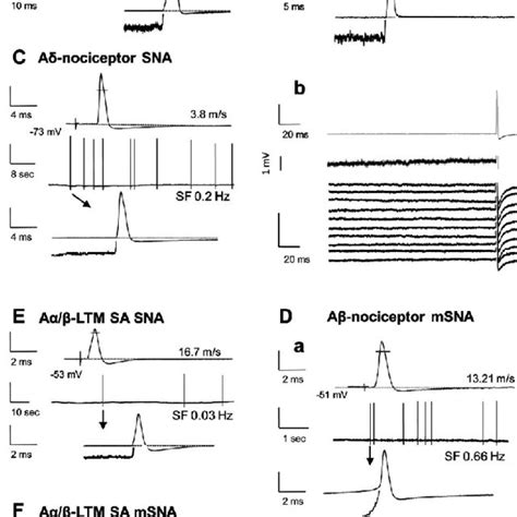 Diagram Of Models The L5 Spinal Nerve Was Ligated With 60 Silk
