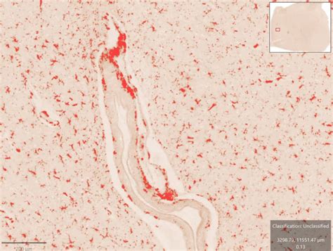 Pixel Classifier On Cd68 Microglia While Excluding Cd68 Epithelia