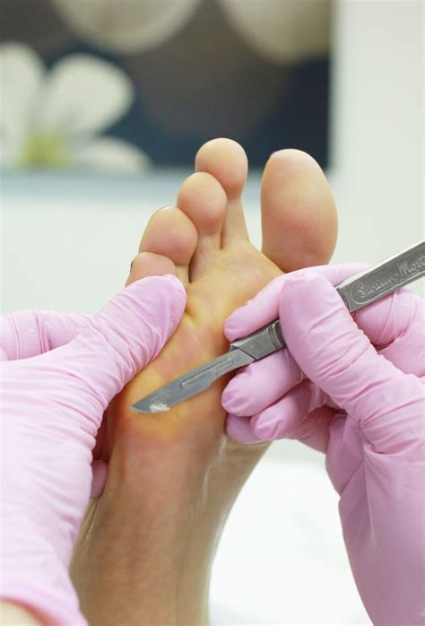 Pedicure Voeten And Zo Risico Voetverzorging