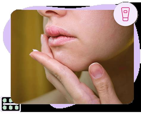 Cold Sores Pillsorted