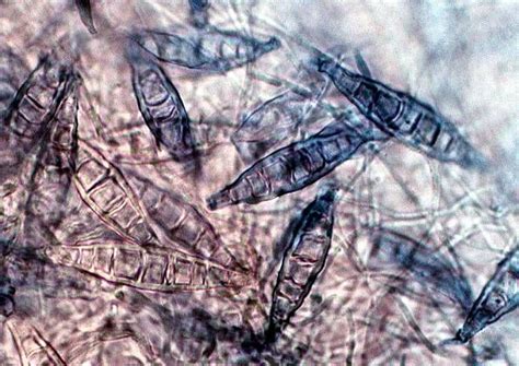 Ringworm Under Microscope