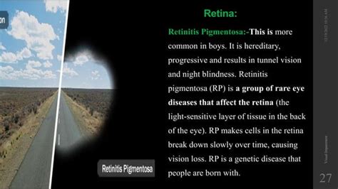 Visual Impairment Ppt