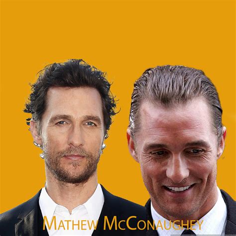 Matthew Mcconaughey Hair Transplant A Journey Of Transform