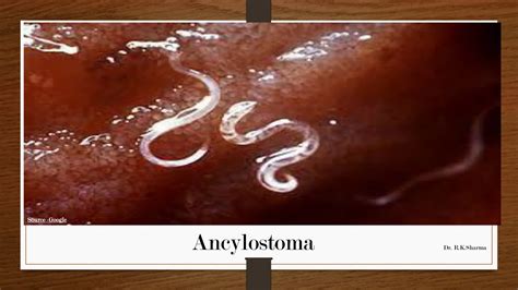 Genus Ancylostoma Pdf Parasitology Lecture Pdf