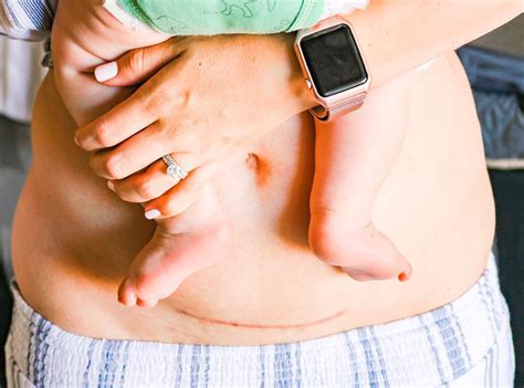 What You Need To Know About How Spinal Anesthesia Is Used