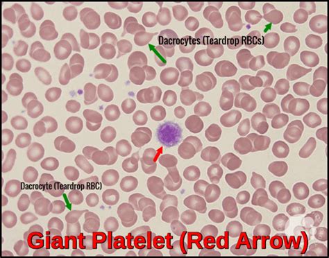 Platelets Under Microscope