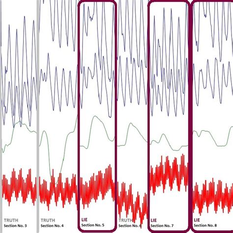Polygraph Diagram In Which Sections Corresponding To Each Of The 10
