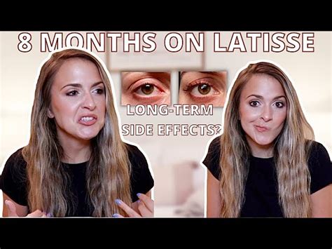Latisse Before And After Side Effects How Long Does Latisse Take To