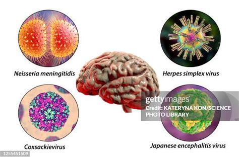 Encephalitis Photos And Premium High Res Pictures Getty Images