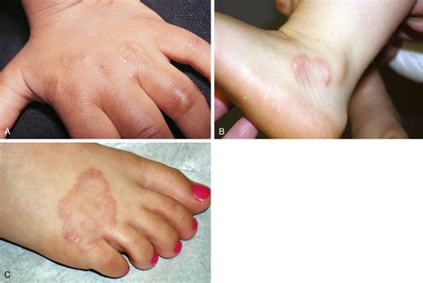 Dermatology Clinical Tree