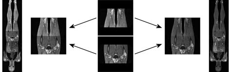 Matching And Merging Without Left And With Right Histogram