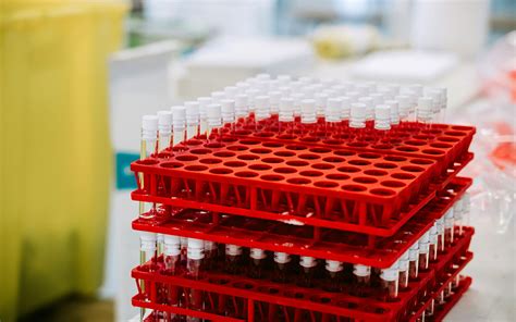 Mini Brains And Lab On A Chip Wearables Jumar Bioincubator Officially