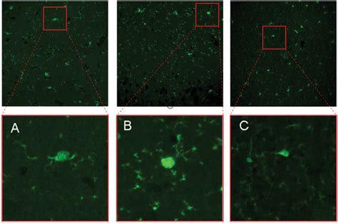 Immunostaining Of Cd11b Marker To Show The Microglia Activation In In