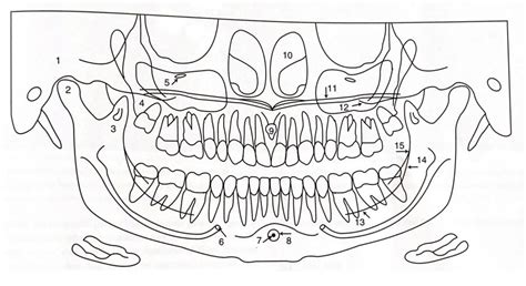 Radiographic Interpretation Diagram Quizlet