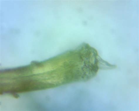 Lyme Pathogen At 10000x 2500x And 1000x Can You See That This Might