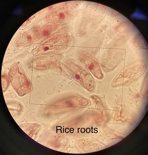 Help Adapting The Root Squash Method To Observe Mitotic Events In Shoot