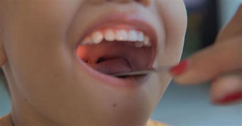 Out With It New Tonsillectomy Guidelines Padek Healthcare Pharmacy