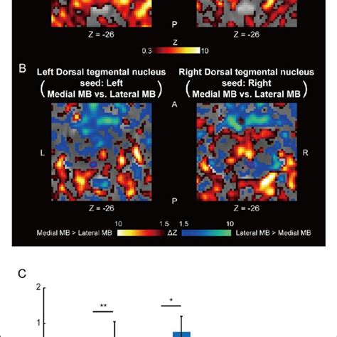 Functional Connectivity In The Dorsal Tegmental Nucleus A Download Scientific Diagram