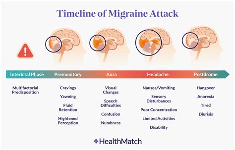 Migraine Treatment