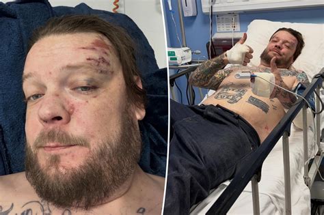 Corey Harrison Of Pawn Stars Breaks 11 Ribs In Scary Motorcycle Crash