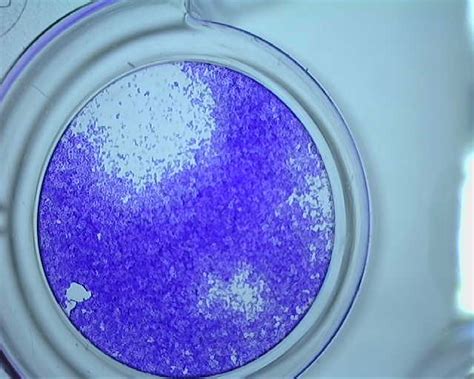 Machine Learning Based Automated Quantification Machine For Virus