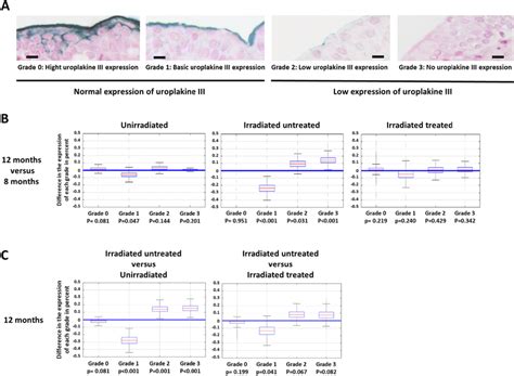 Evolution Of Uroplakin Iii Grades As A Function Of Time At 8 And