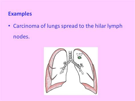 Lecture 42 Neoplasia 3 Dr Ppt Video Online Download