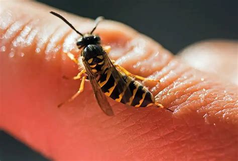 What Happens If You Leave A Bee Stinger In 10 Emergency Conditions