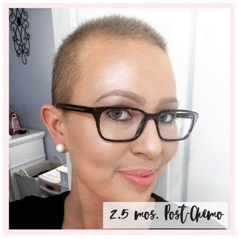 Post Chemo Hair Growth Timeline Chemo Haare Frisuren