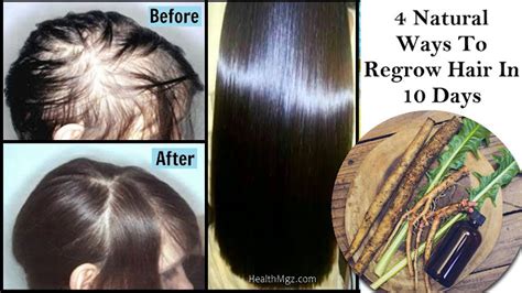 4 Natural Ways To Regrow Hair In 10 Days Healthy Lifestyle