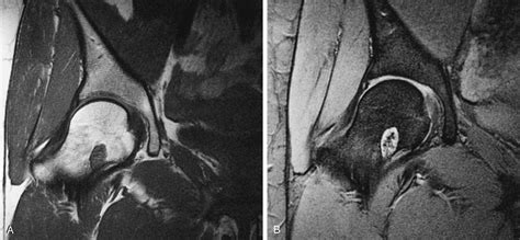 Hips And Pelvis Clinical Tree