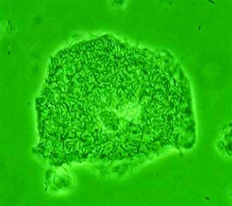 Adhered Streptococci To A Buccal Epithelial Cell Download Scientific
