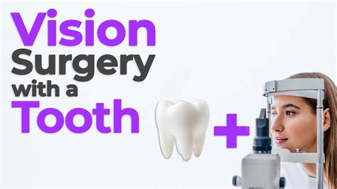 Limit Of Detection Lod Vs Limit Of Quantification Loq