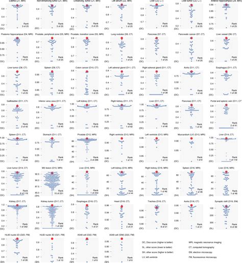 nnu net a self configuring method for deep learning based biomedical image segmentation nmmitools