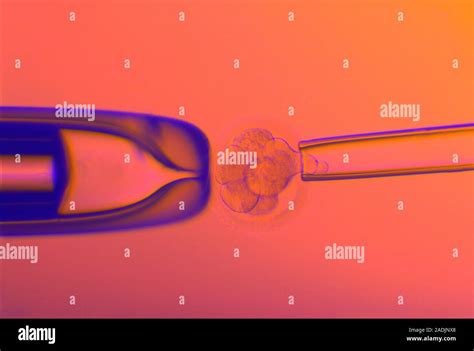 Ivf Embryo Testing Image 4 Of 5 Coloured Light Micrograph Of An Ivf
