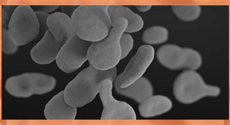 Síntomas Del Streptococcus Pyogenes Archivos Mala Espina