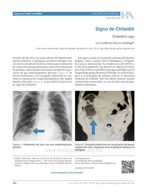 Pdf Signo De Chilaiditi