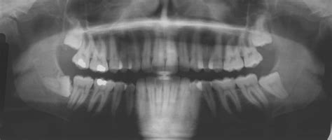 Alan P Chun Dds Md Inc Top Quality Care For Your Smile