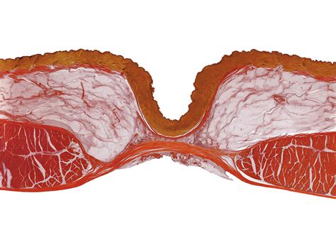 Belly Button Anatomy Diagram