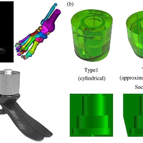 Design Of The Ankle Prosthesis Inspired By The Human Ankle Foot