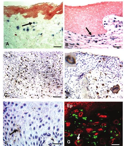 Histochemical Staining For Tryptase A B A Mast Cell Distribution In