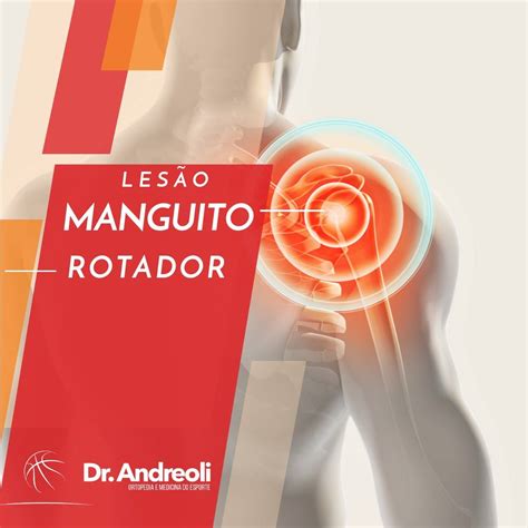 Dr Andreoli O Que é Manguito Rotador Simplificando Para Que Você