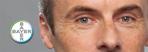 Liam Condon To Become Bayer Cropscience Ceo Andnowuknow