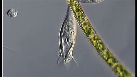 Opercularia Ciliado Youtube