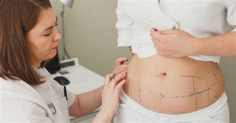 Everything You Need To Know About Liposuction Surgery Beanstalk Mums