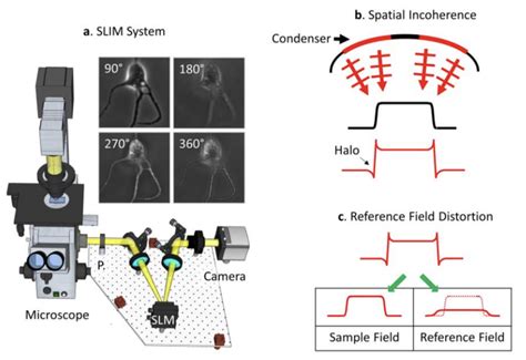 Real Time Halo Correction In Phase Contrast Imaging Biomedical Optics Express 9 623 2018
